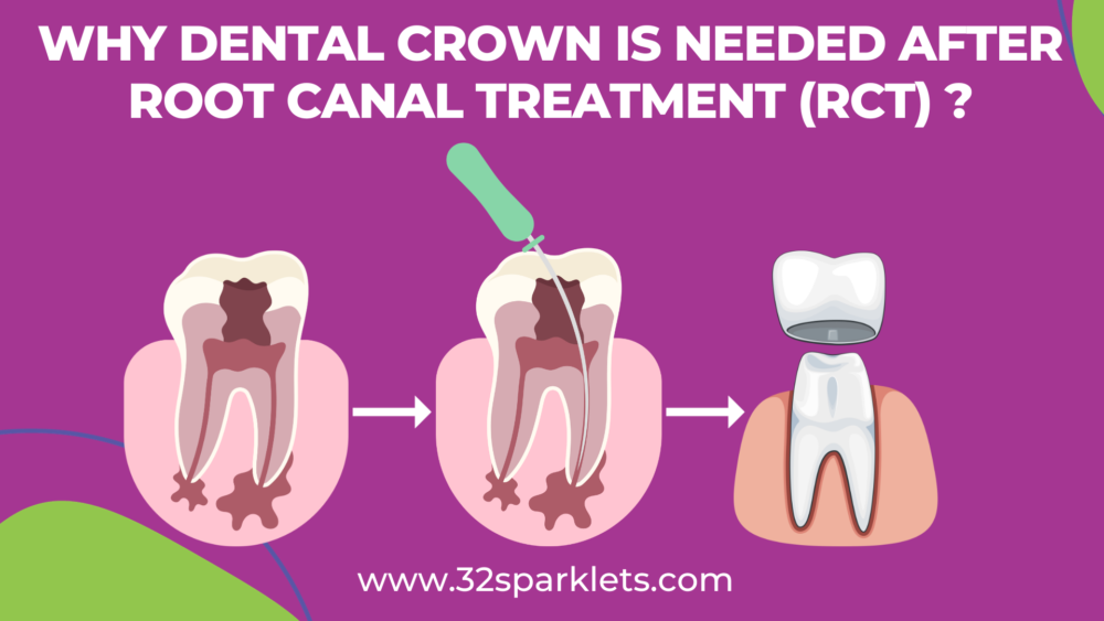 Why Dental Crown or Cap is needed after Root Canal Treatment (RCT ...